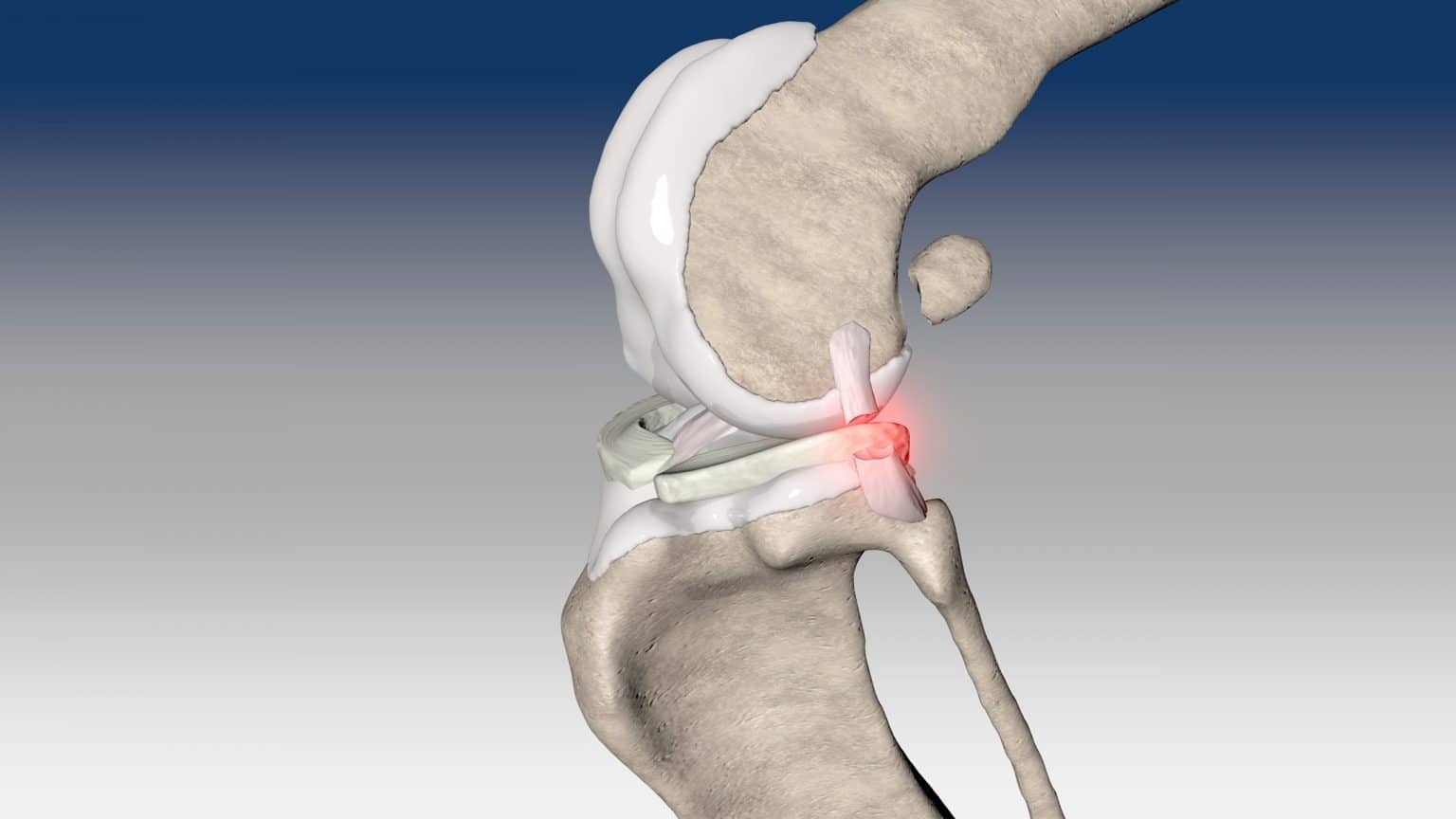 Applications - Novetech Surgery