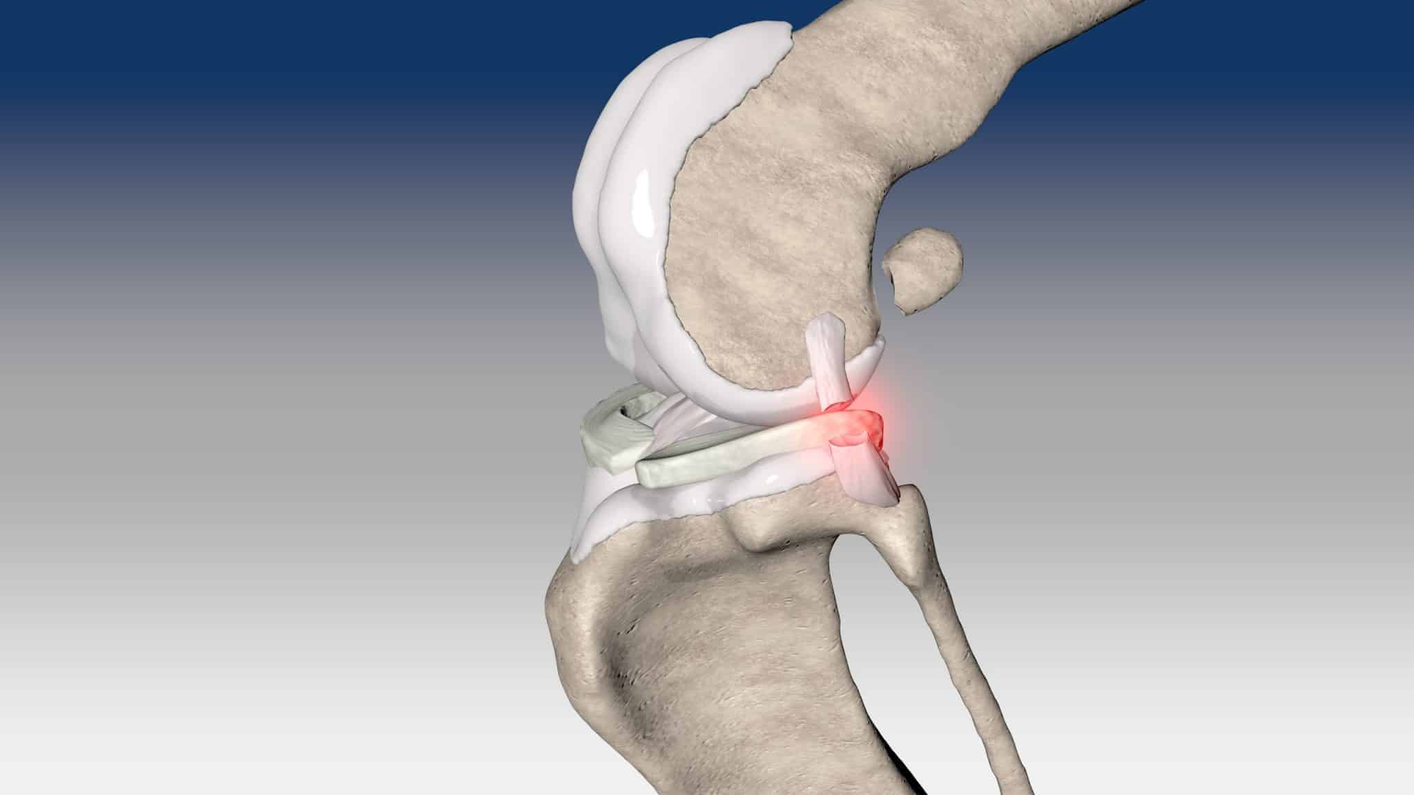 Applications - Novetech Surgery