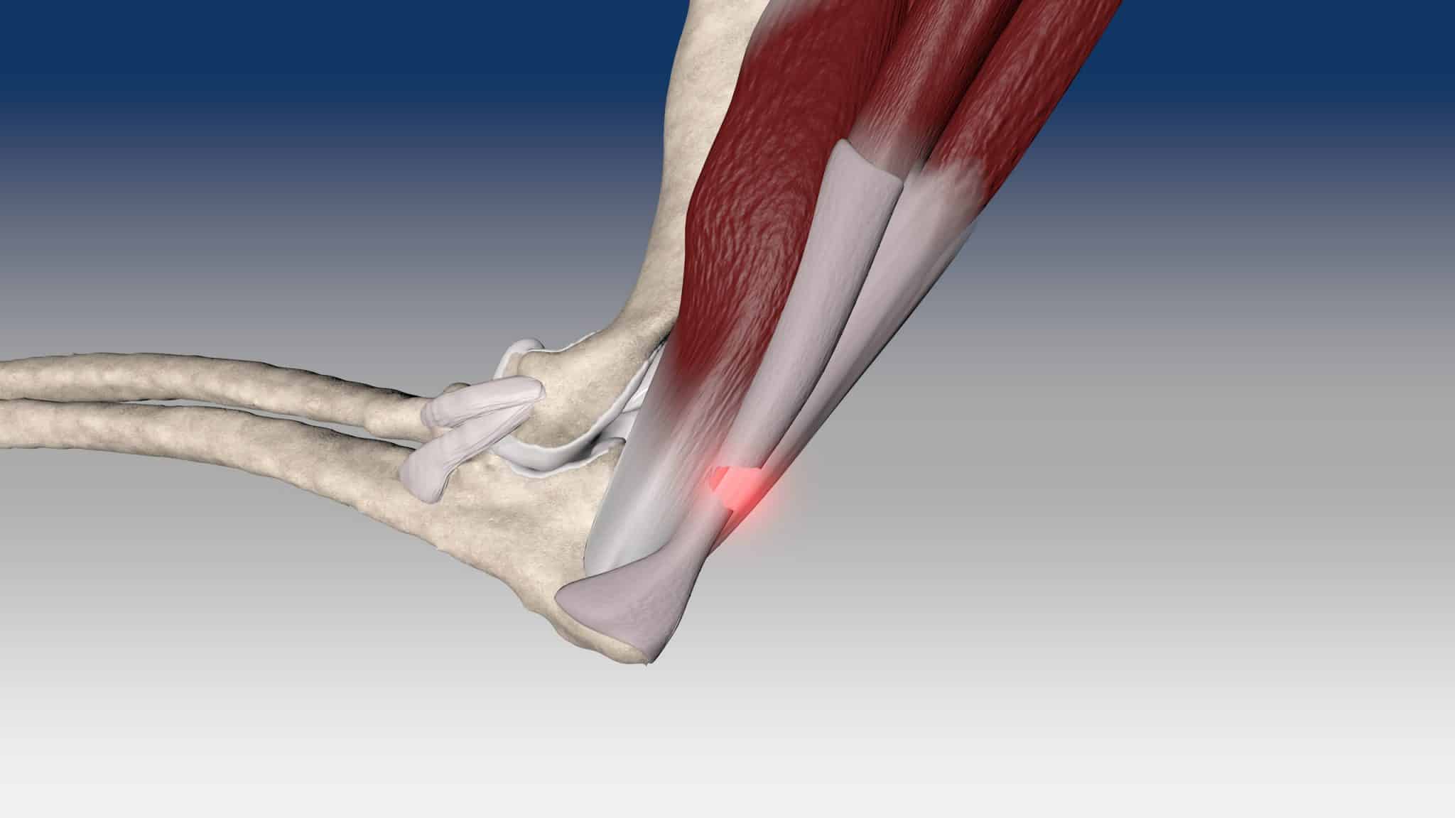 Applications - Novetech Surgery