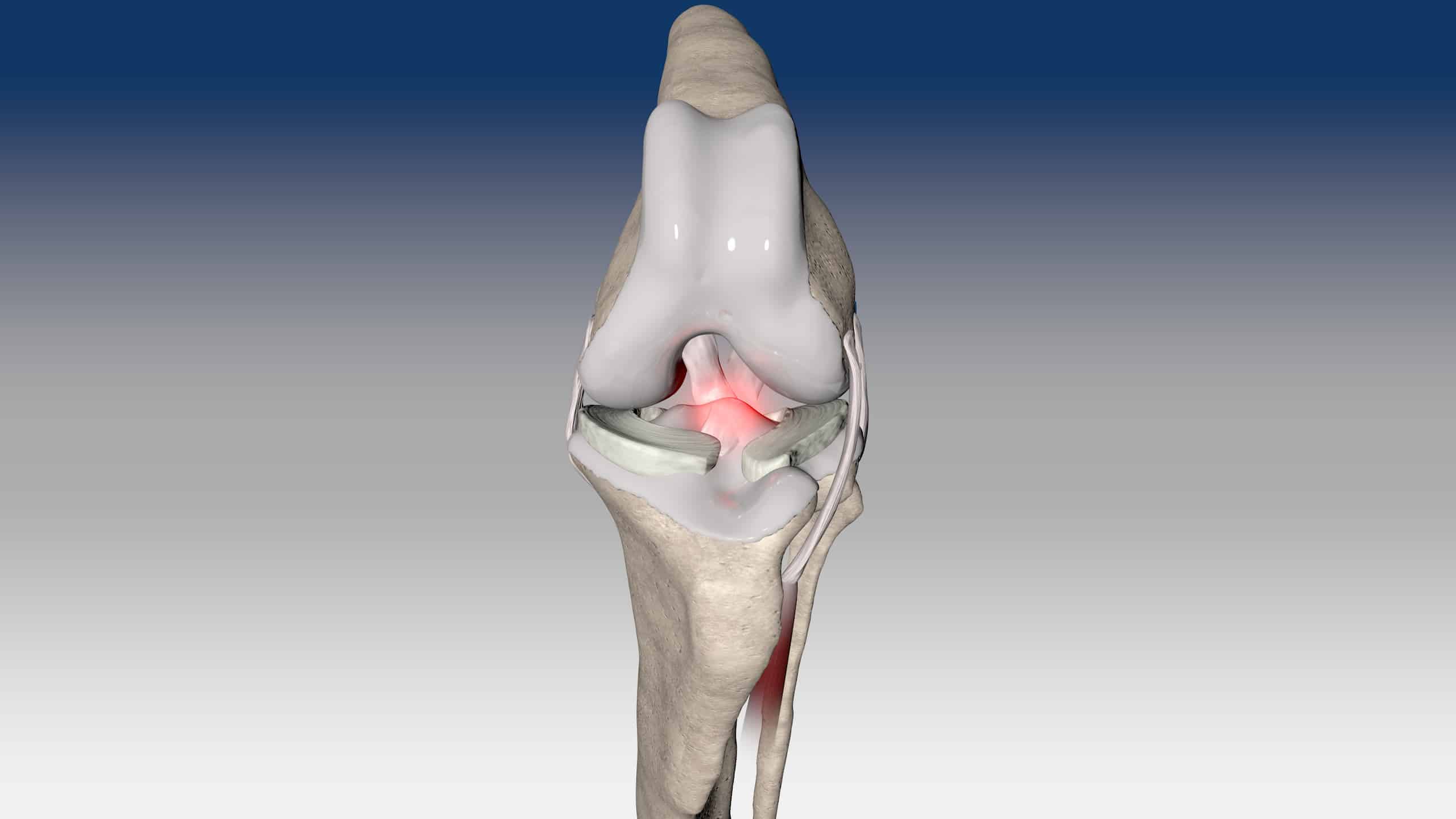Extra-articular stabilization of cranial cruciate ligament - Novetech ...