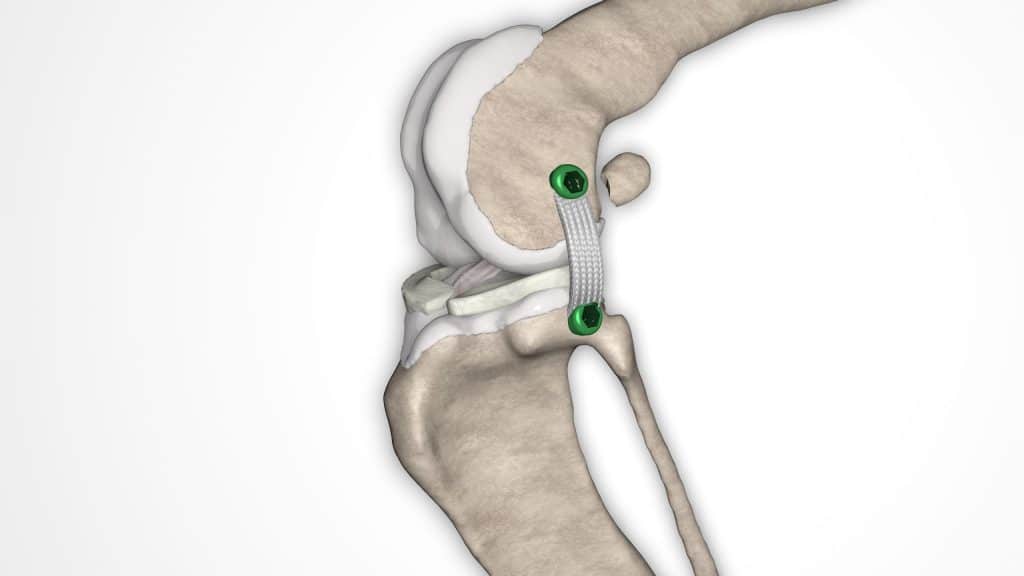 Lateral collateral stifle ligament reconstruction - Novetech Surgery