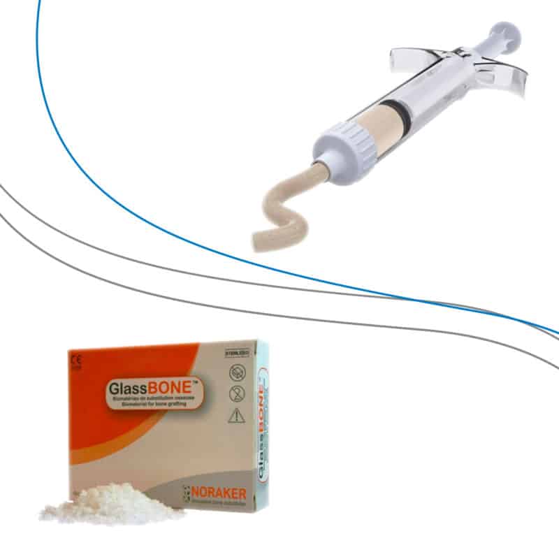 GlassBONE - Novetech Surgery