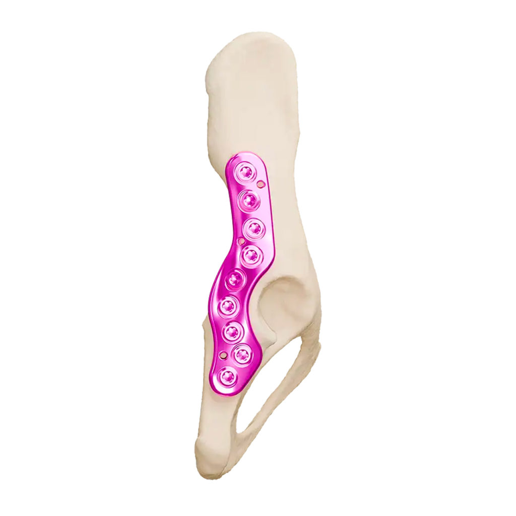 FUSION IMPLANTS – ACE Feline Acetabular Anatomic Plate - Novetech Surgery