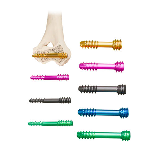 FUSION IMPLANTS – HISS - Novetech Surgery